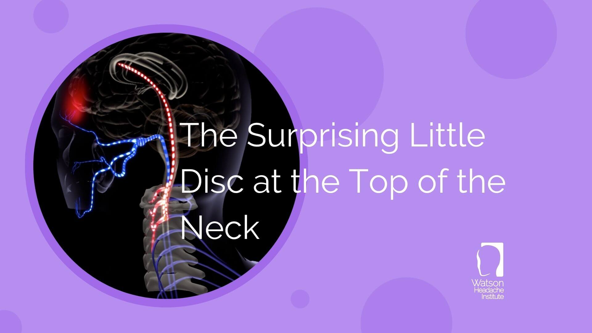 The Surprising Little Disc at the Top of the Neck - Watson Headache